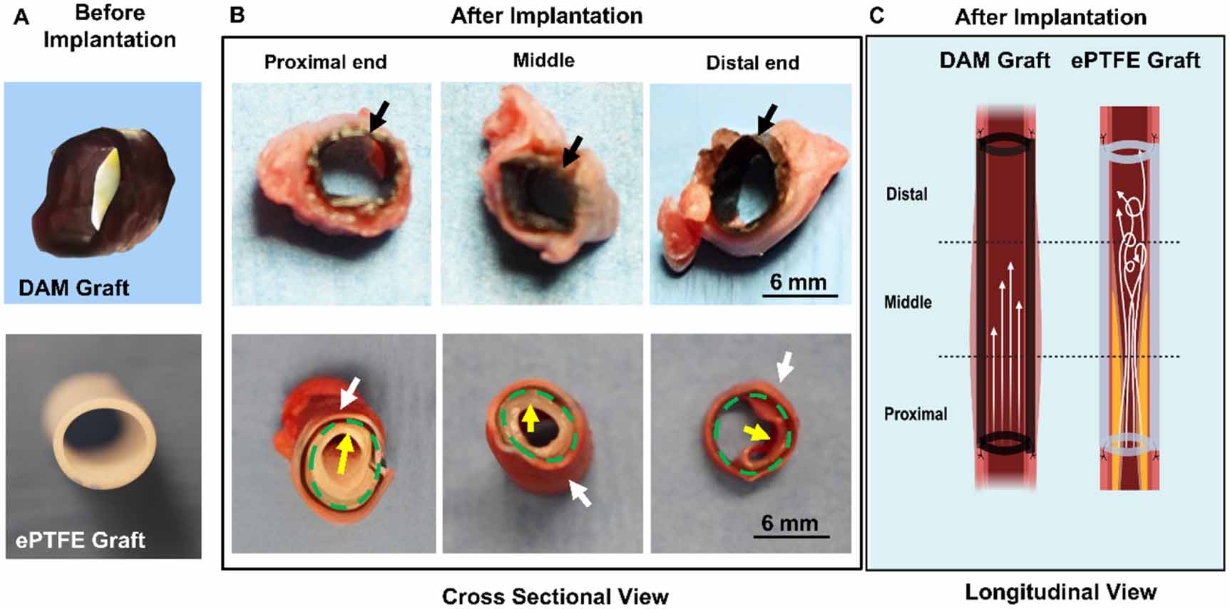 Biofabrication of small-diameter vascular graft with acellular human ...
