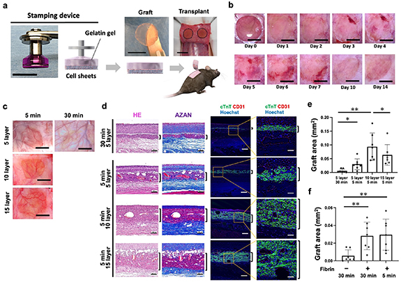 Cardiomyocyte sheet stacking using fibrin enables high-speed ...