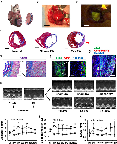 Cardiomyocyte sheet stacking using fibrin enables high-speed ...