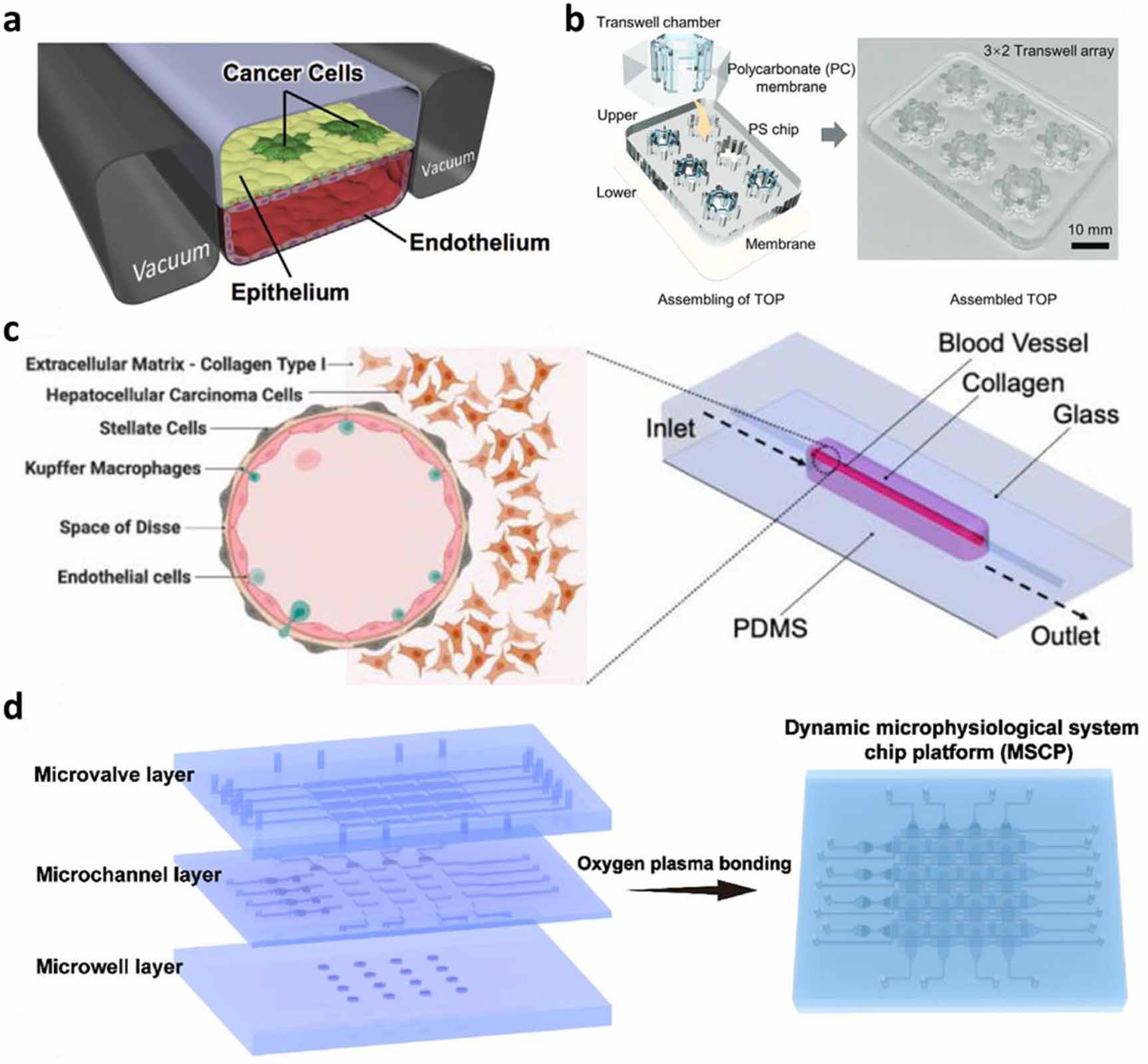 Tumor organoid and tumor-on-a-chip equipped next generation precision ...