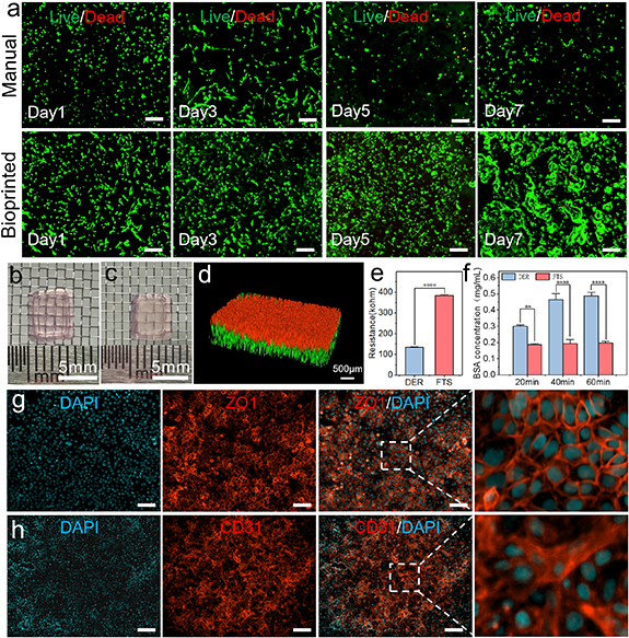 Construction of a 3D bioprinted skin model for psoriasis research and ...