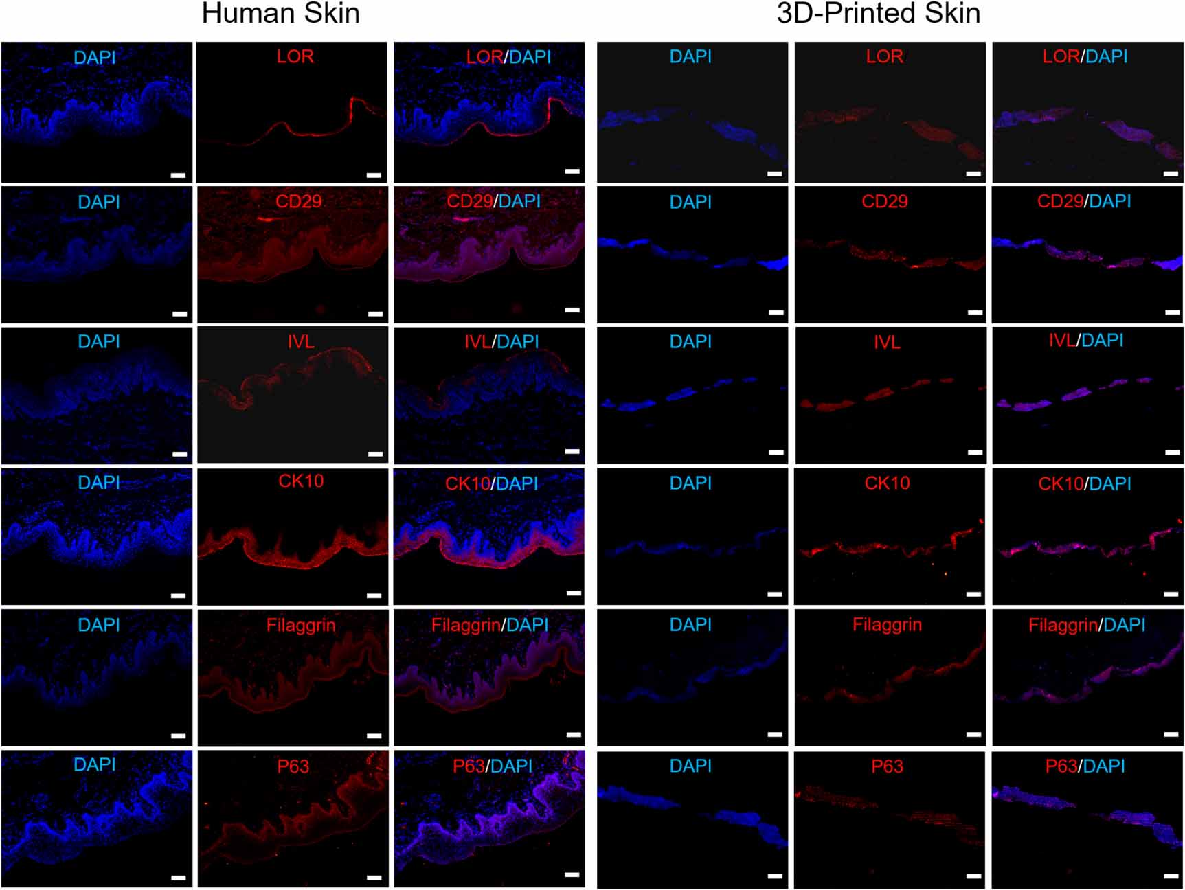 Construction of a 3D bioprinted skin model for psoriasis research and ...