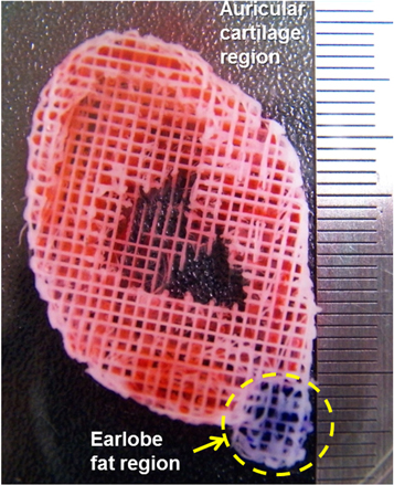 Auricular reconstruction using biofabrication-based tissue engineering ...