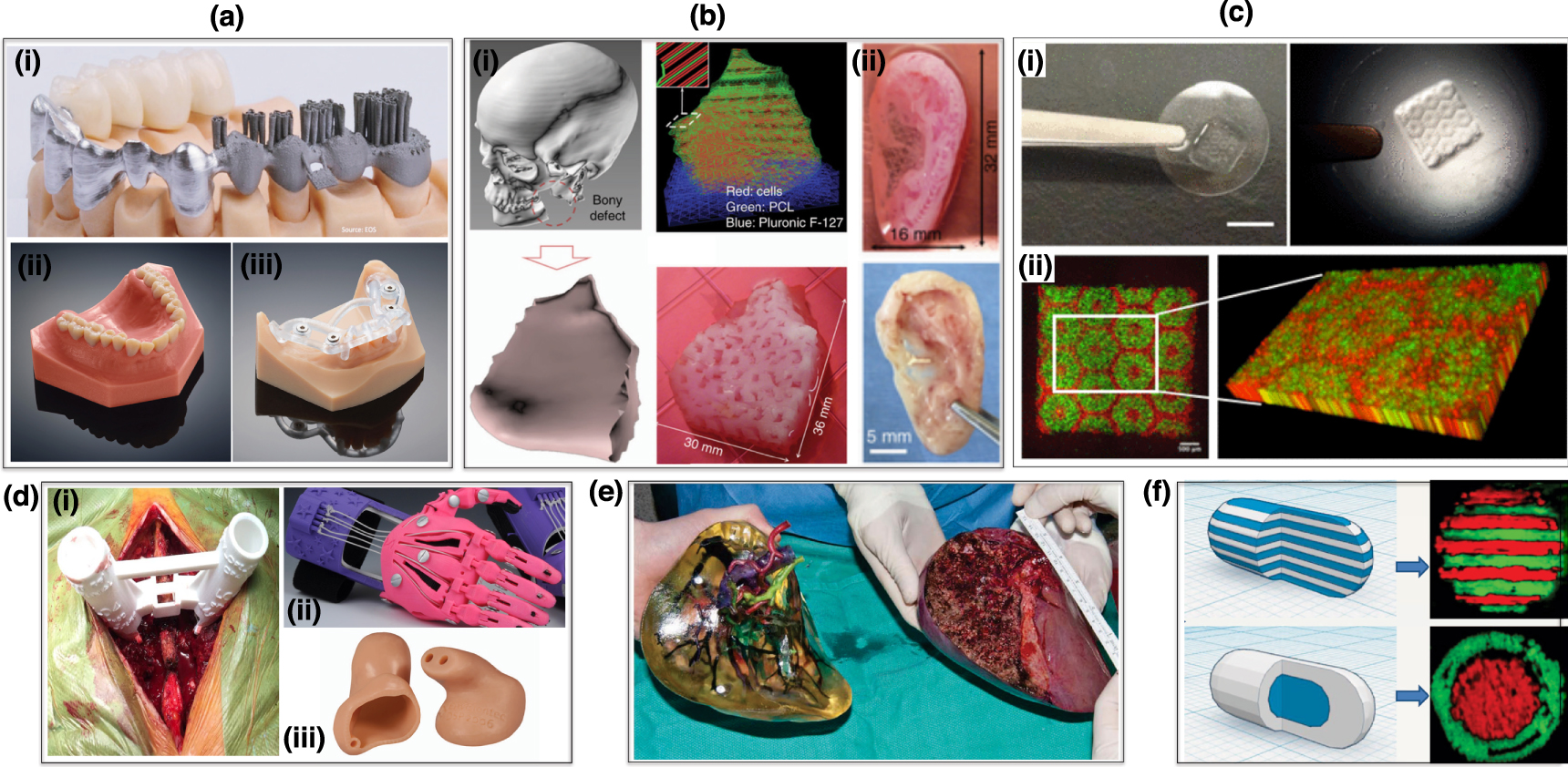 Current and emerging applications of 3D printing in medicine - IOPscience