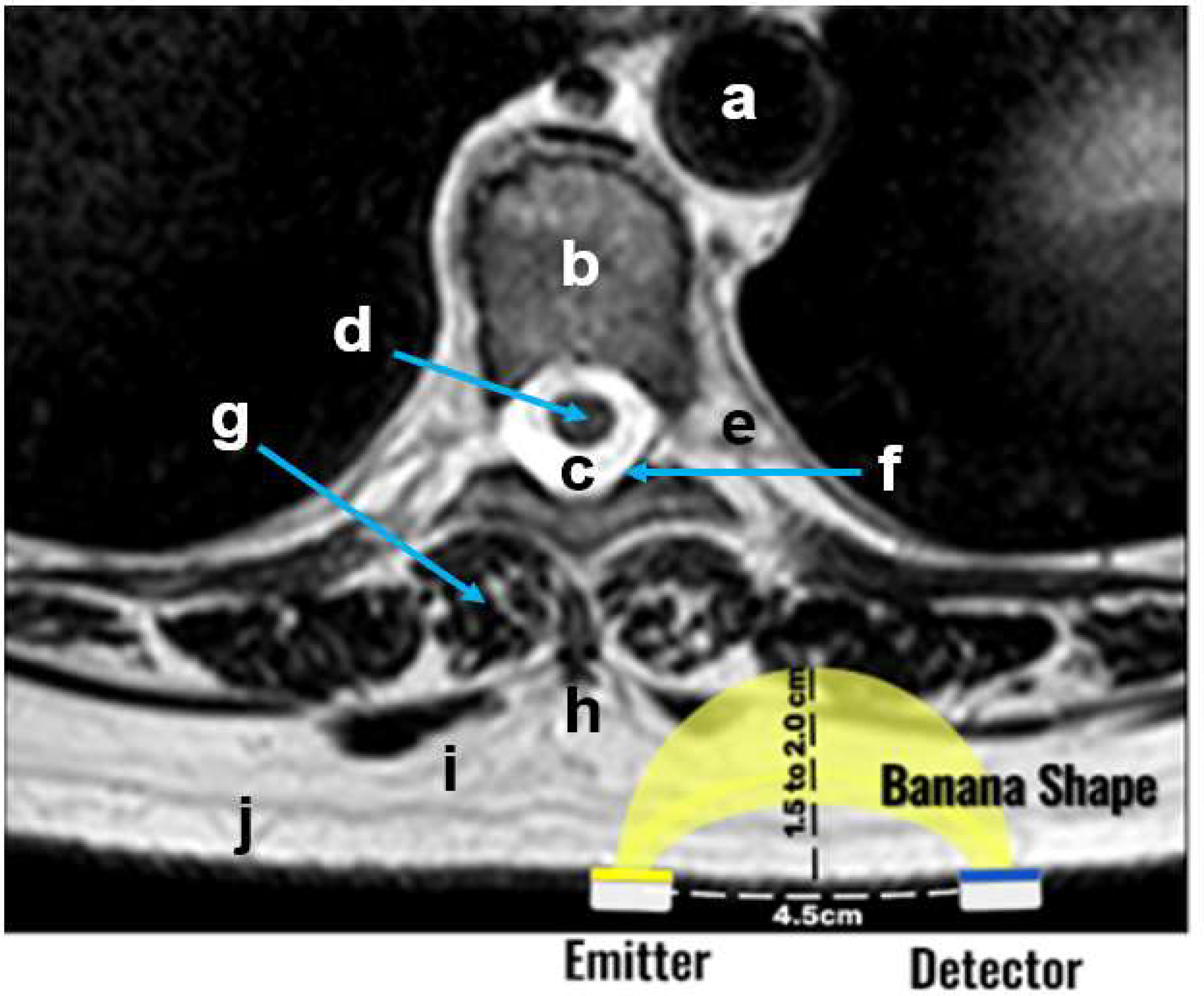 Comparison of LED- and LASER-based fNIRS technologies to record the ...
