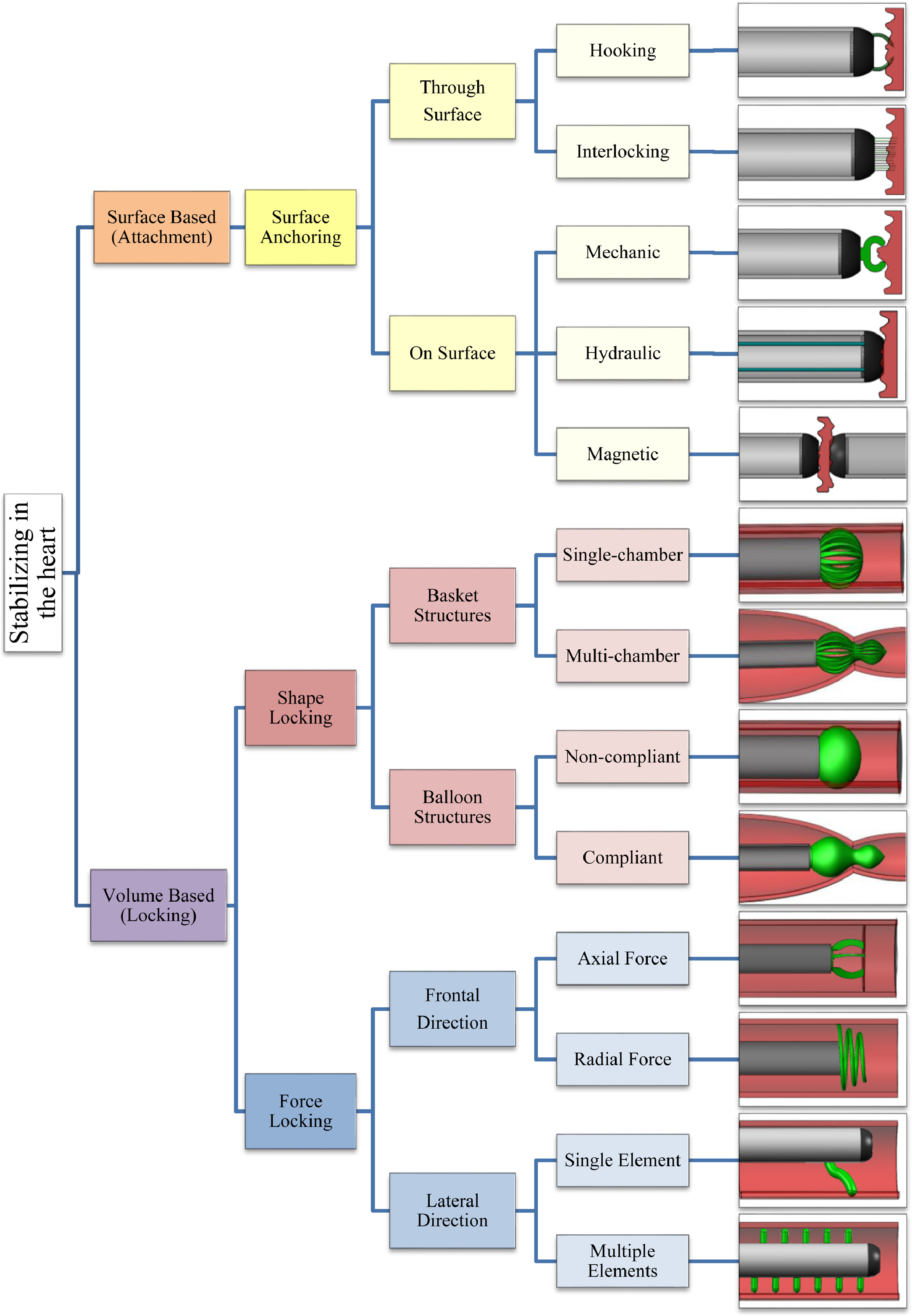Stabilizing interventional instruments in the cardiovascular system: A ...