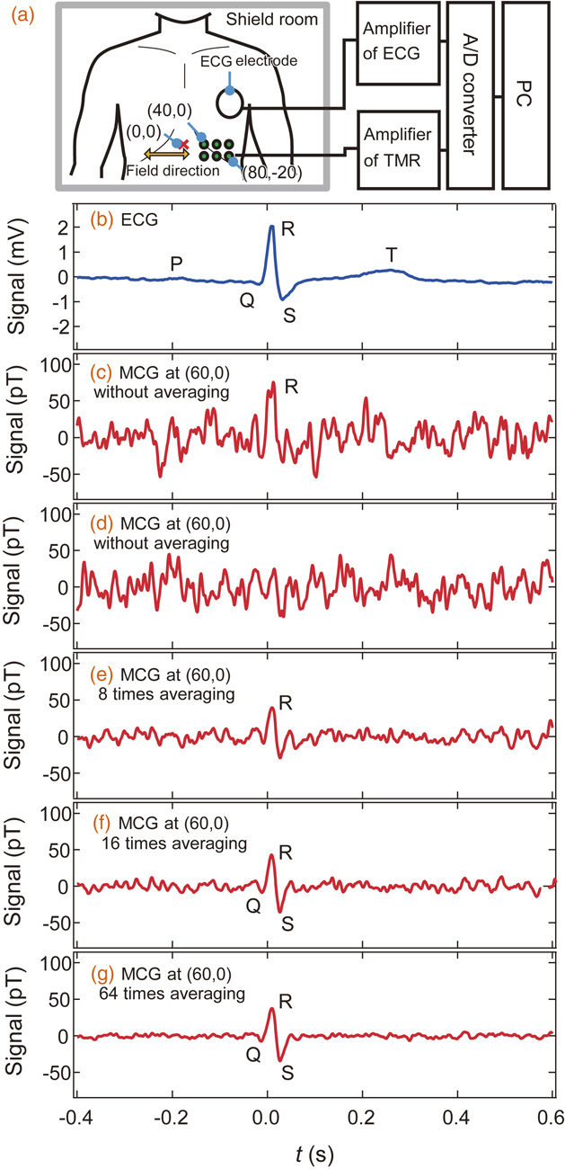 Magnetocardiography and magnetoencephalography measurements at room ...