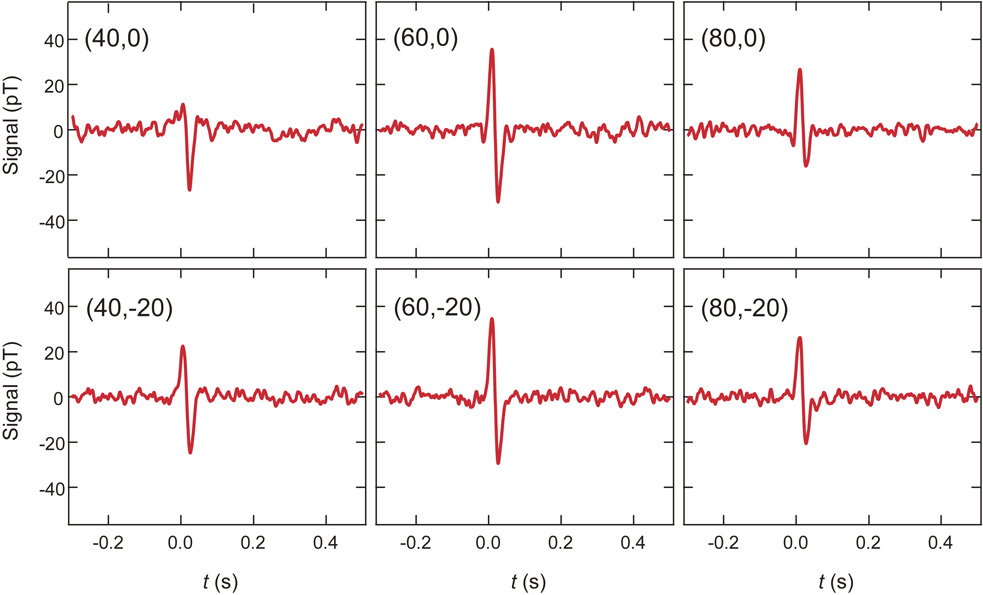 Magnetocardiography and magnetoencephalography measurements at room ...