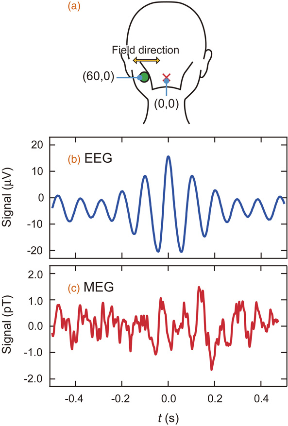 Magnetocardiography and magnetoencephalography measurements at room ...