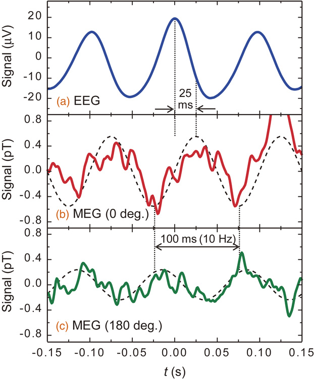 Magnetocardiography and magnetoencephalography measurements at room ...