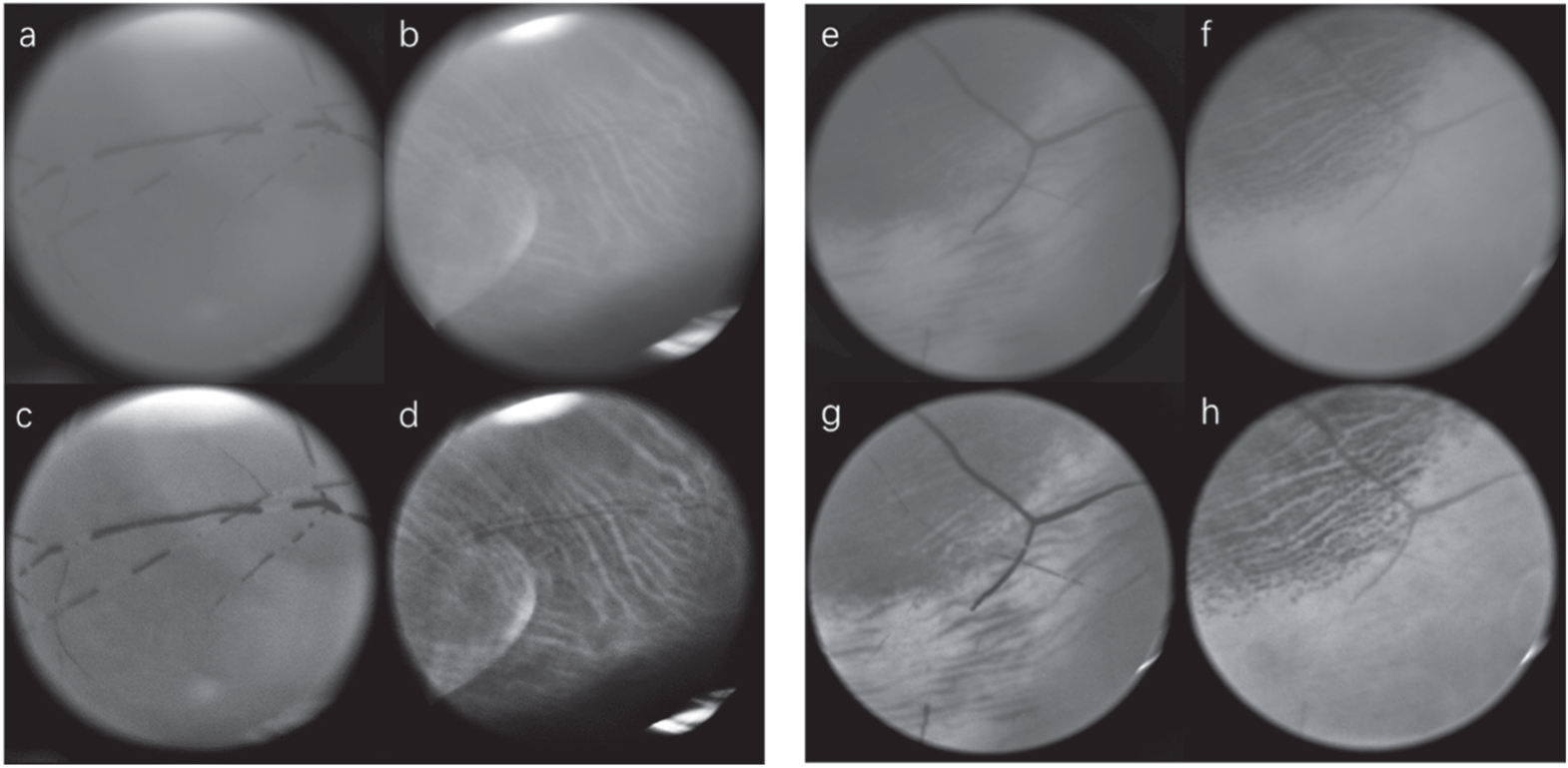 Near-infrared fundus imaging system with light illumination from an ...