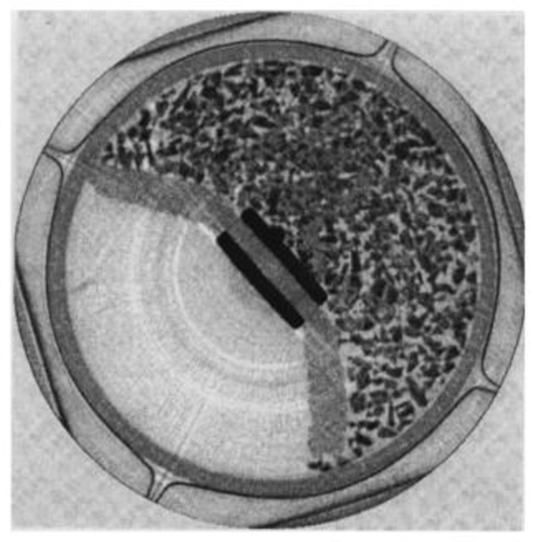 Investigation of the Inner Structures of ZEBRA Cells with a ...