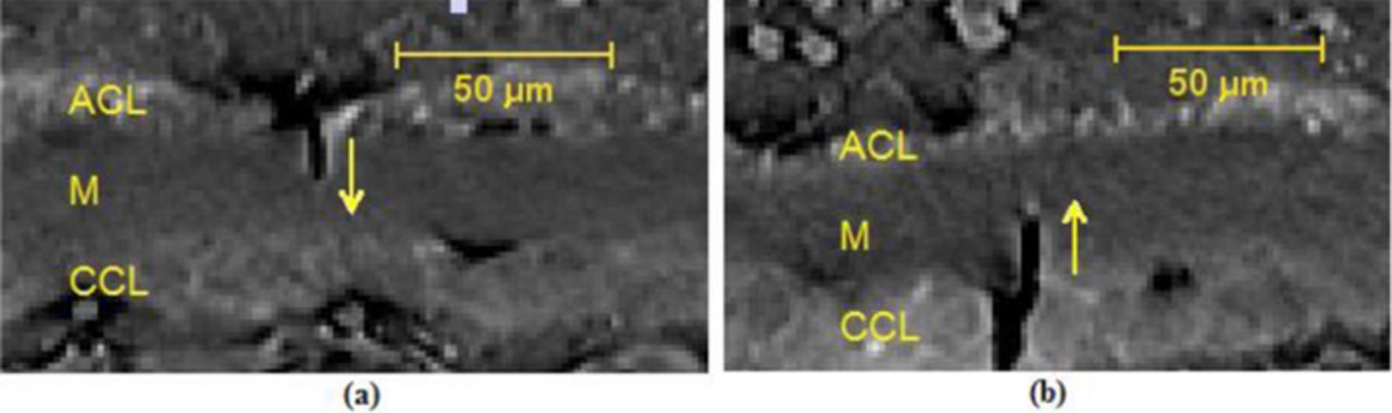 3D Failure Analysis of Pure Mechanical and Pure Chemical Degradation in ...