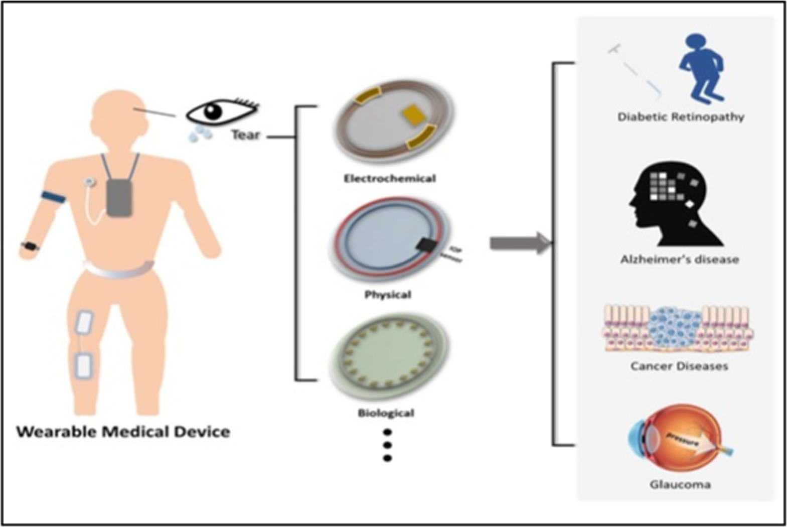 Review—Recent Progress, Challenges, and Trends in Polymer-Based ...