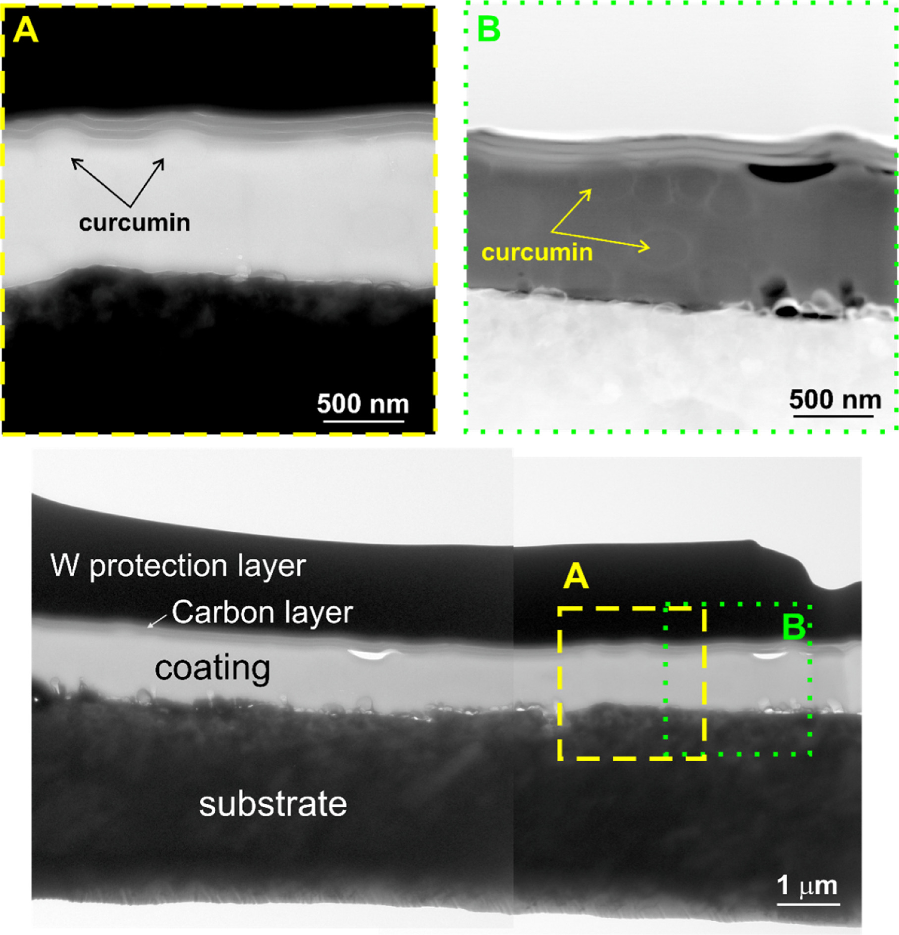 Electrophoretic Deposition and Characterization of Curcumin/Chitosan ...