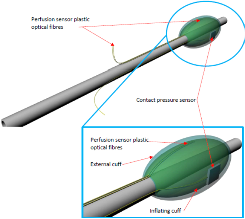 Biomedical application of optical fibre sensors - IOPscience