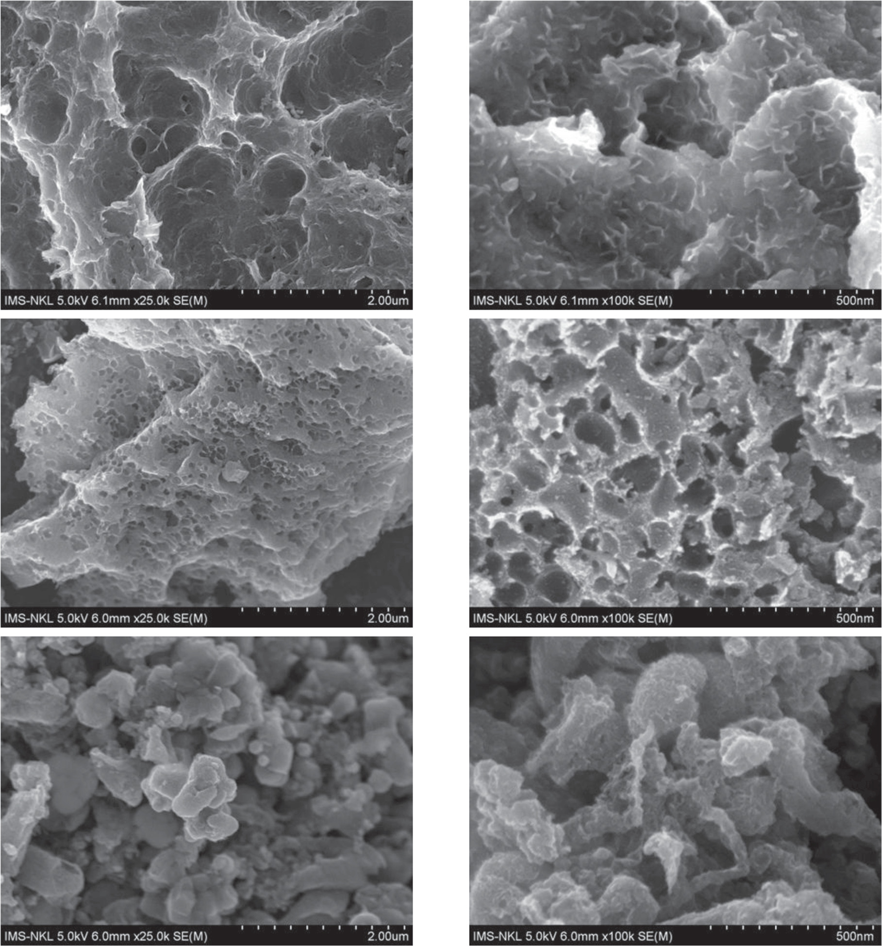 Chitosan derived N-doped carbon aerogel nanostructures for high-performance supercapacitors ...
