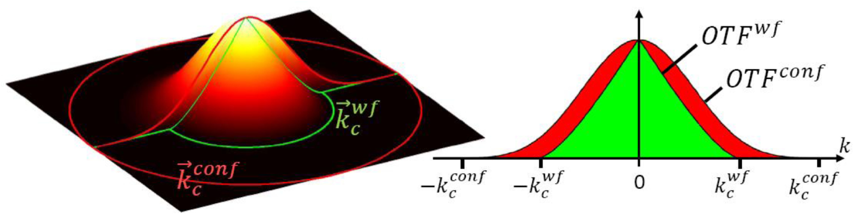 A joint Richardson—Lucy deconvolution algorithm for the reconstruction of multifocal structured ...