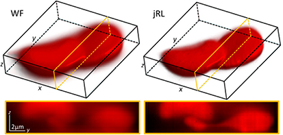 A joint Richardson—Lucy deconvolution algorithm for the reconstruction of multifocal structured ...