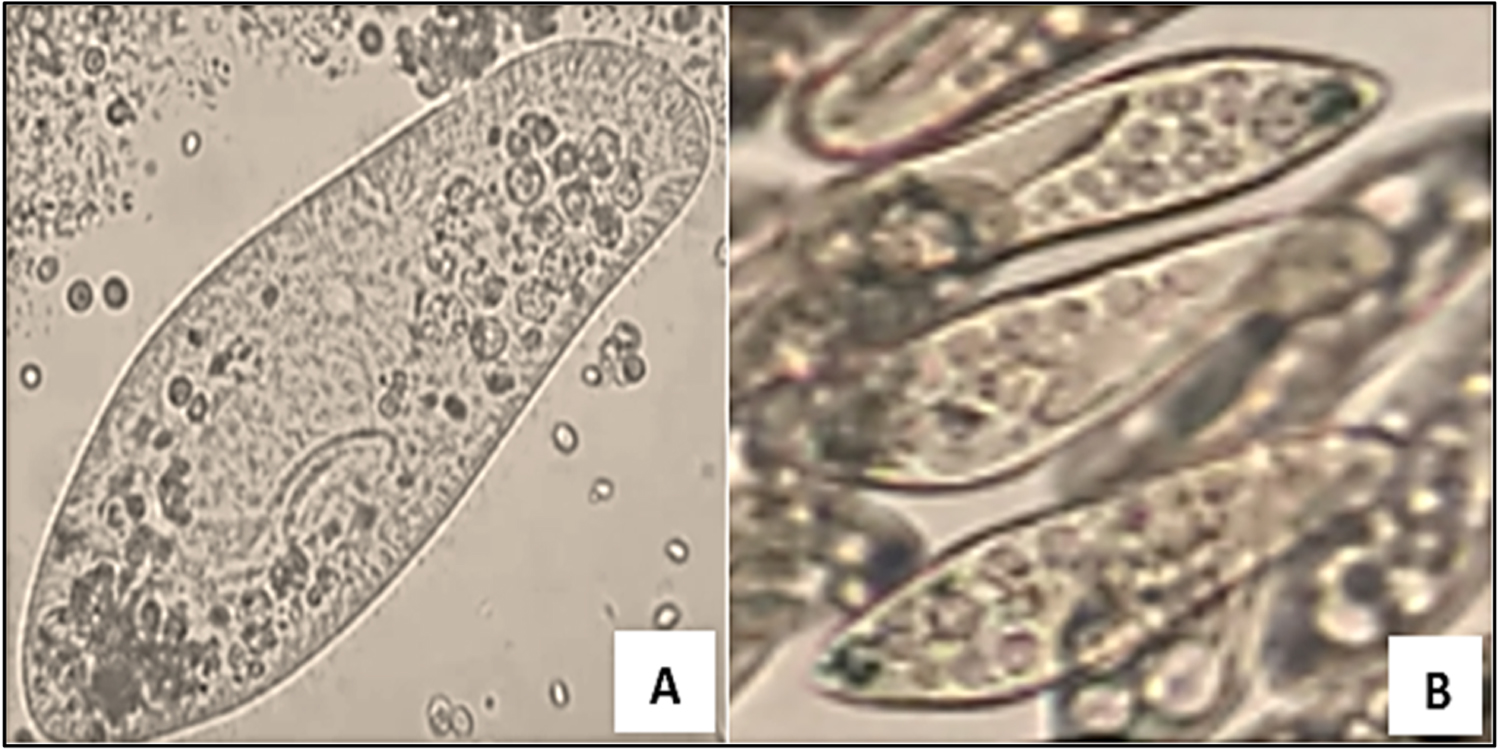 Paramecium Under Microscope 100x Labeled
