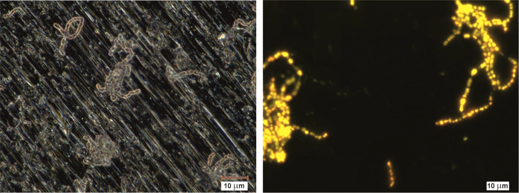 Comparative study of cell interaction and bacterial adhesion on ...