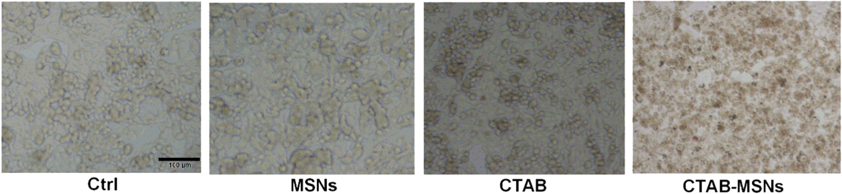 Facile synthesis of cetyltrimethylammonium bromide-loaded mesoporous ...