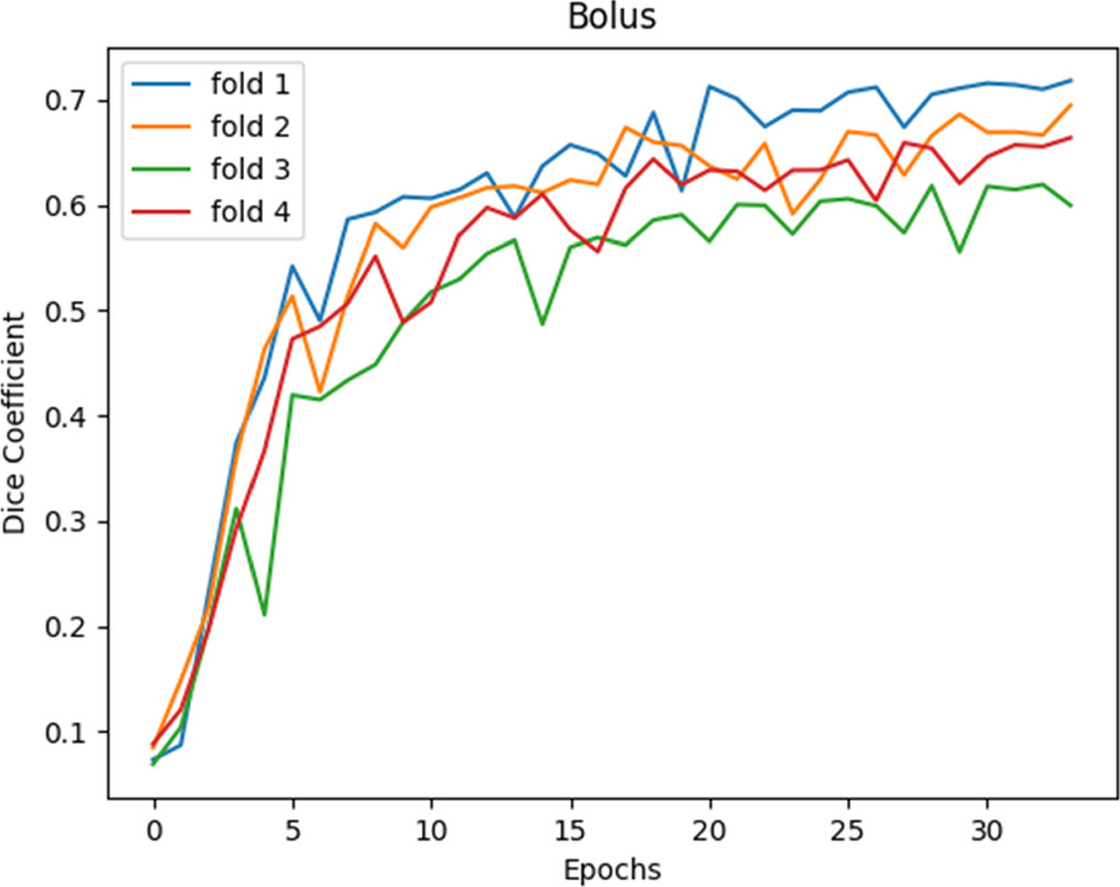 Use of deep learning to segment bolus during videofluoroscopic swallow studies - IOPscience