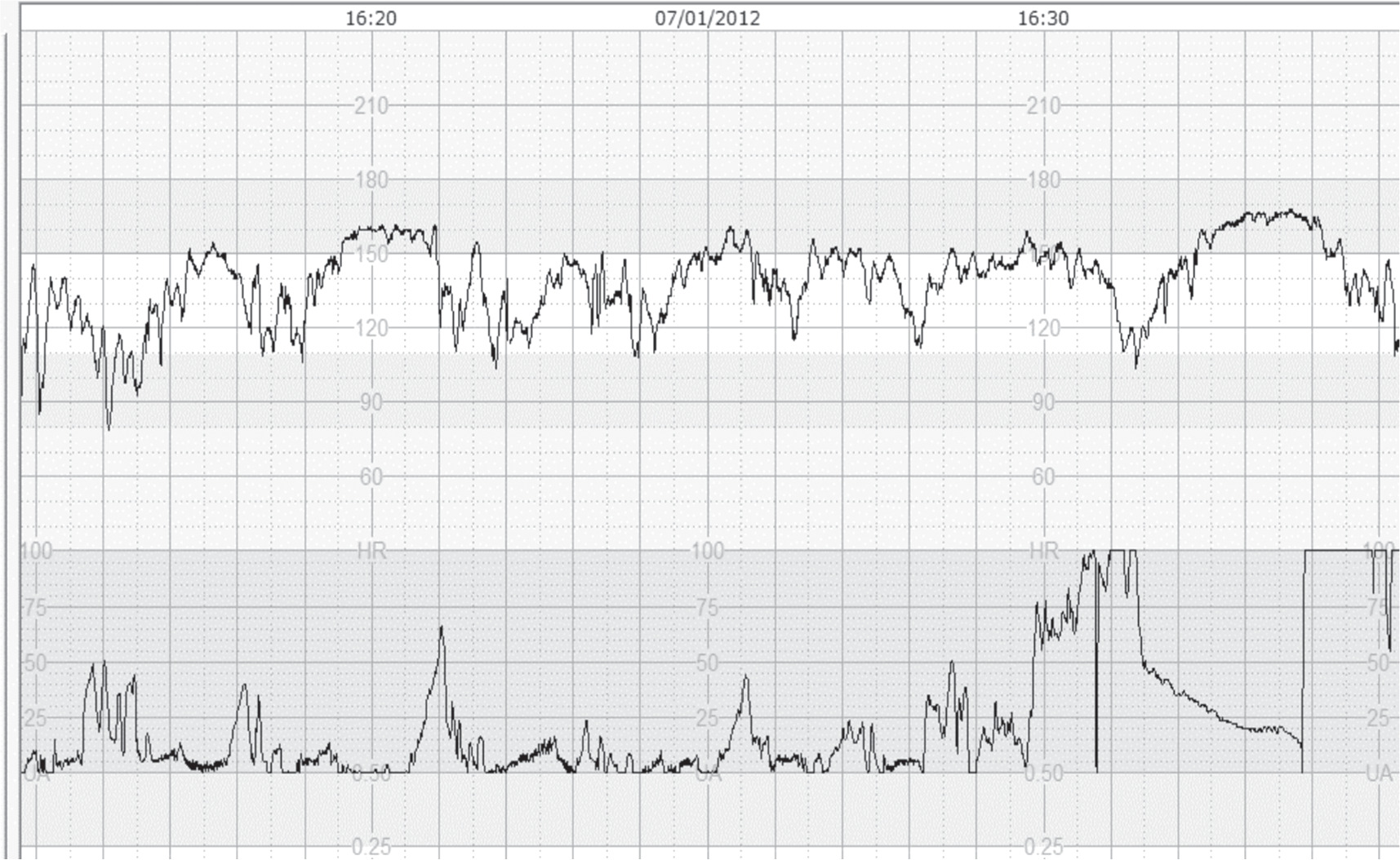 Fetal monitoring technologies for the detection of intrapartum hypoxia ...