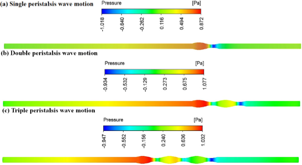 CFD investigation of multiple peristaltic waves in a 3D unobstructed ...