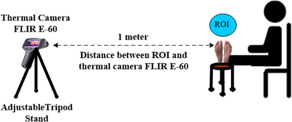 Automated prediction of diabetes mellitus using infrared thermal foot ...
