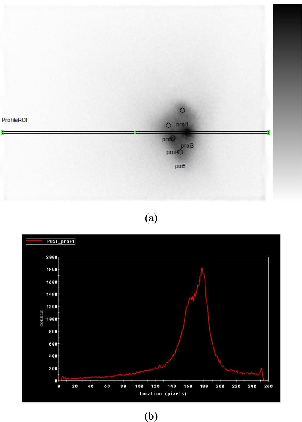 Energy window optimization in bremsstrahlung imaging after Yttrium-90 ...