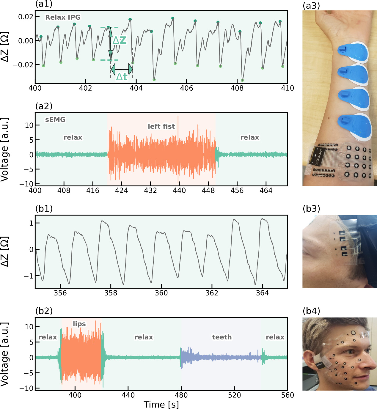 Soft electrodes for simultaneous bio-potential and bio-impedance study ...