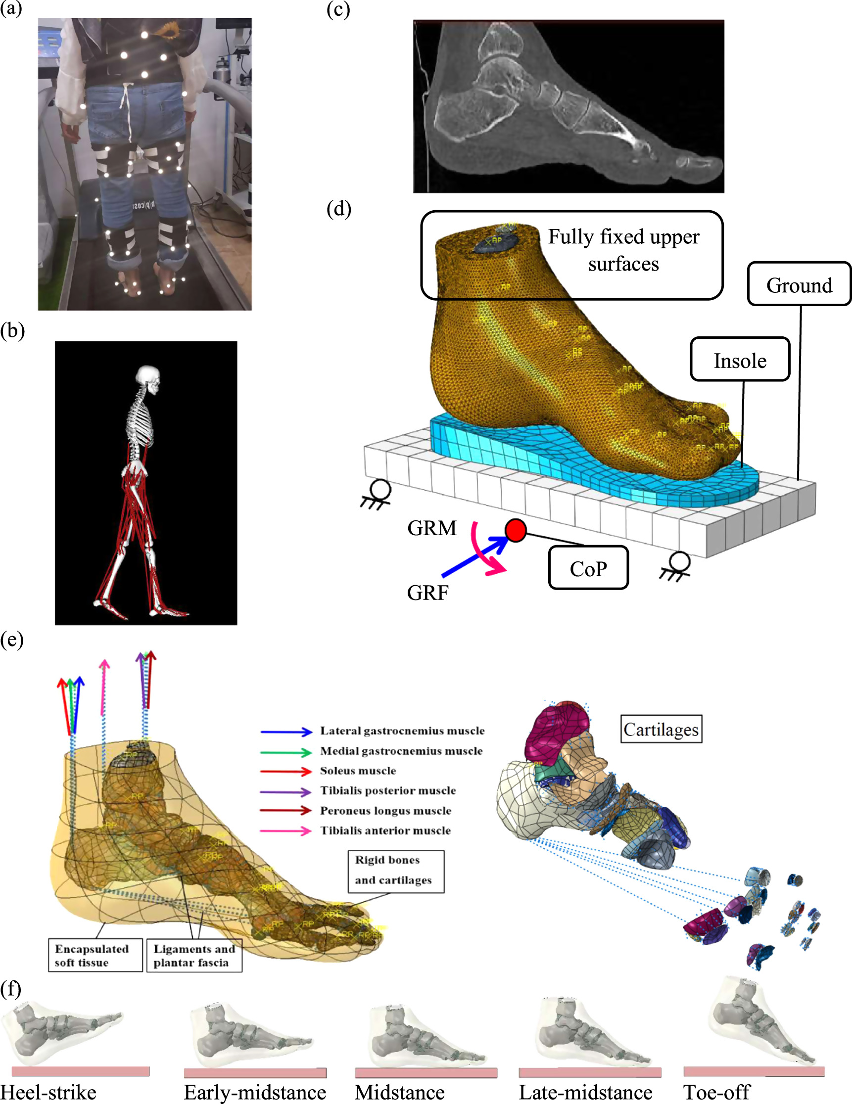 A combined musculoskeletal and finite element model of a foot to ...