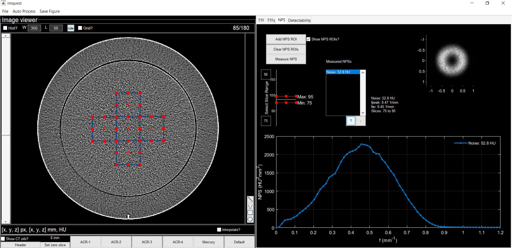 Investigation of a potential upstream harmonization based on image ...