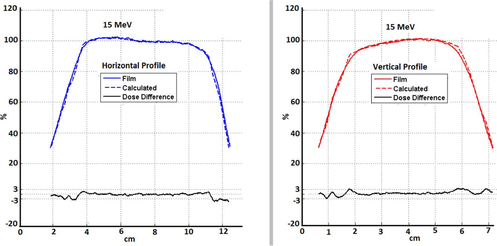 Planar dose calculation of electron therapy - IOPscience