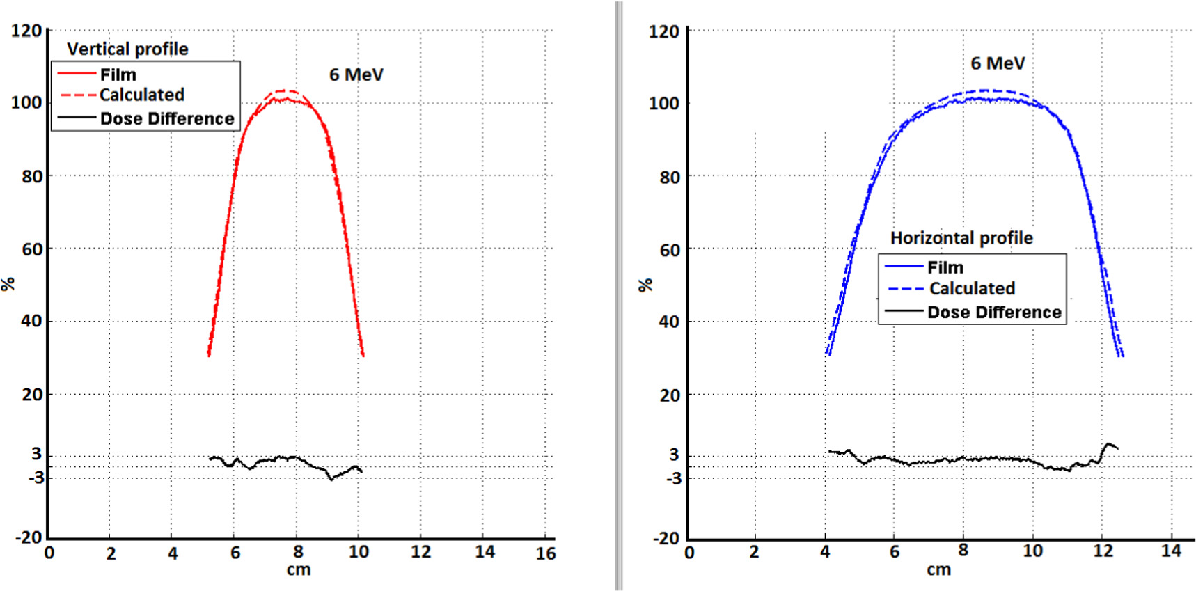 Planar dose calculation of electron therapy - IOPscience