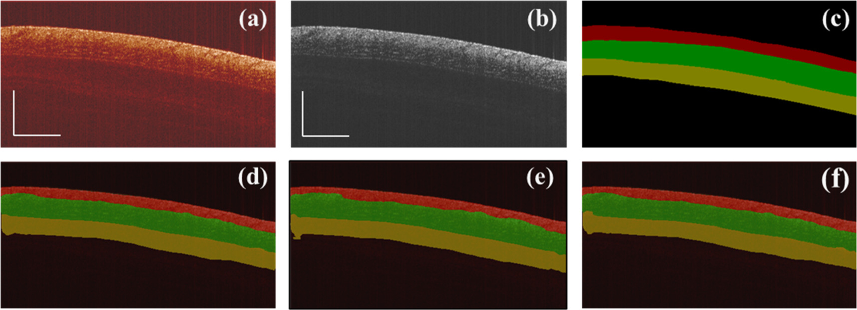 Segmentation and quantitative analysis of optical coherence tomography ...