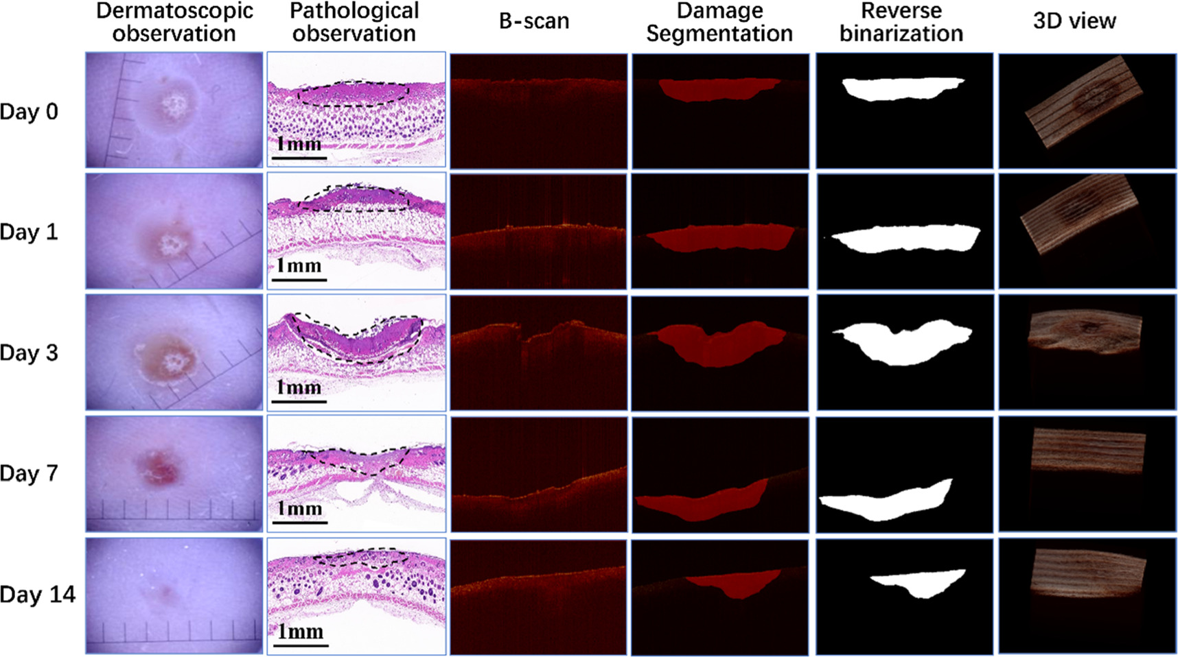 Segmentation and quantitative analysis of optical coherence tomography ...