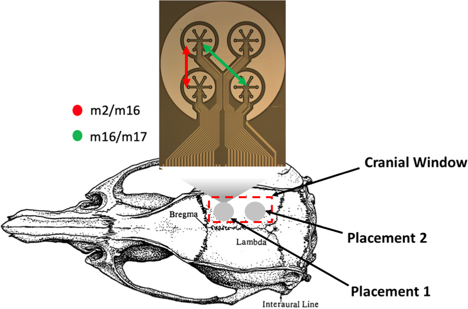 Development of a novel, concentric micro-ECoG array enabling ...