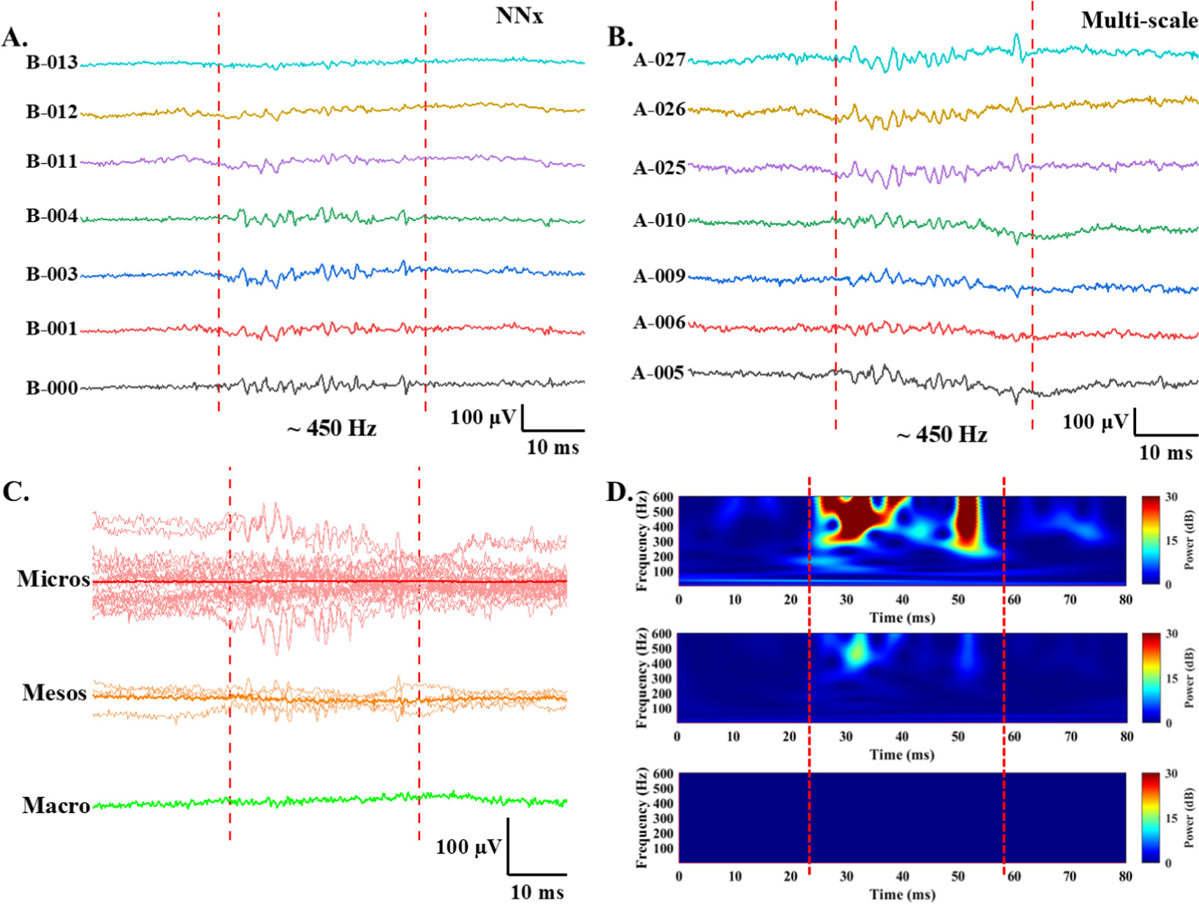 Development of a novel, concentric micro-ECoG array enabling ...