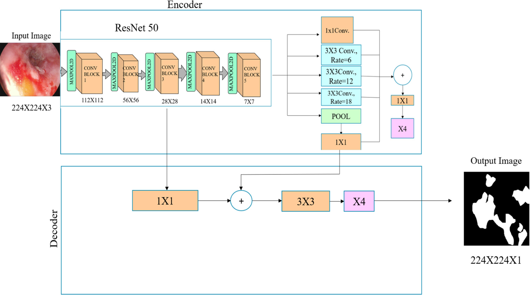 Explainable AI based automated segmentation and multi-stage ...