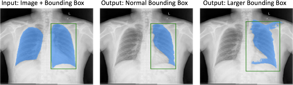 Lung segment anything model (LuSAM): a decoupled prompt-integrated ...