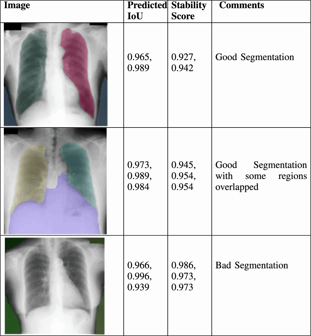Lung segment anything model (LuSAM): a decoupled prompt-integrated ...