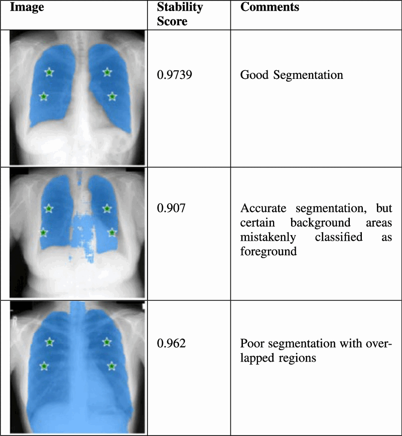 Lung segment anything model (LuSAM): a decoupled prompt-integrated ...