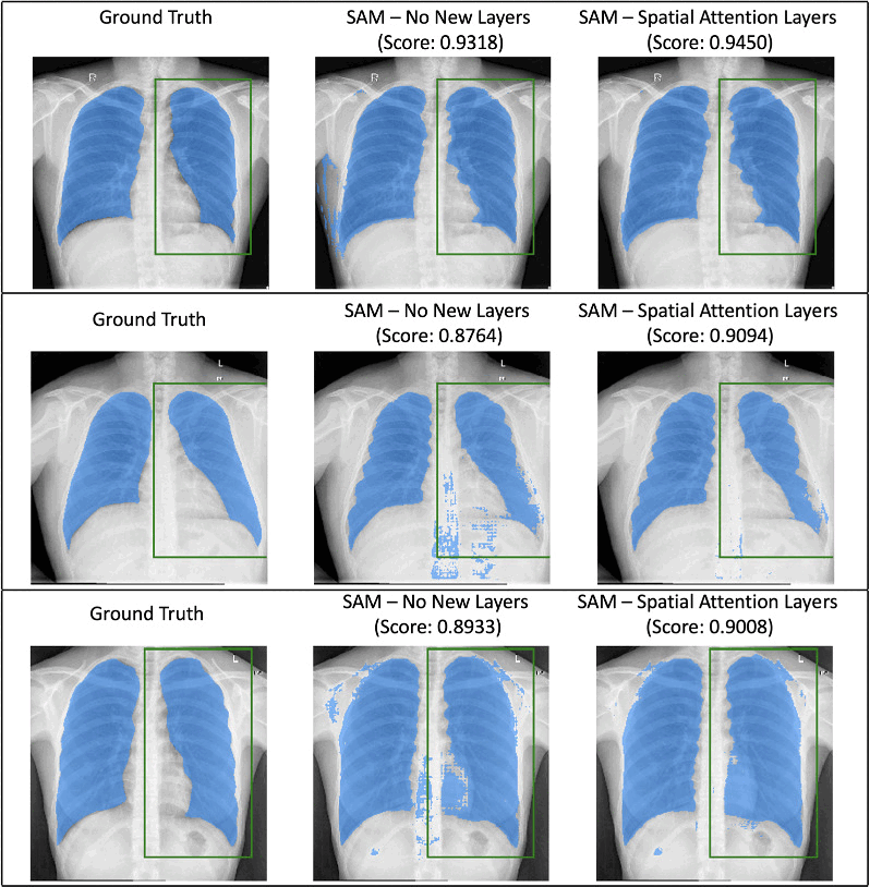 Lung segment anything model (LuSAM): a decoupled prompt-integrated ...