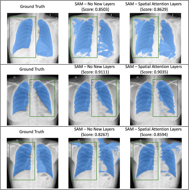 Lung segment anything model (LuSAM): a decoupled prompt-integrated ...