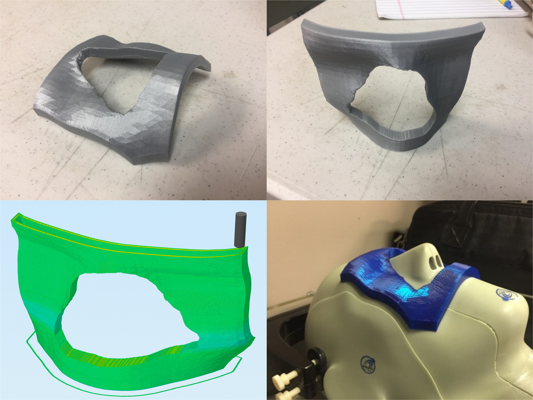 Innovative 3D printing and molding process for secondary-skin ...