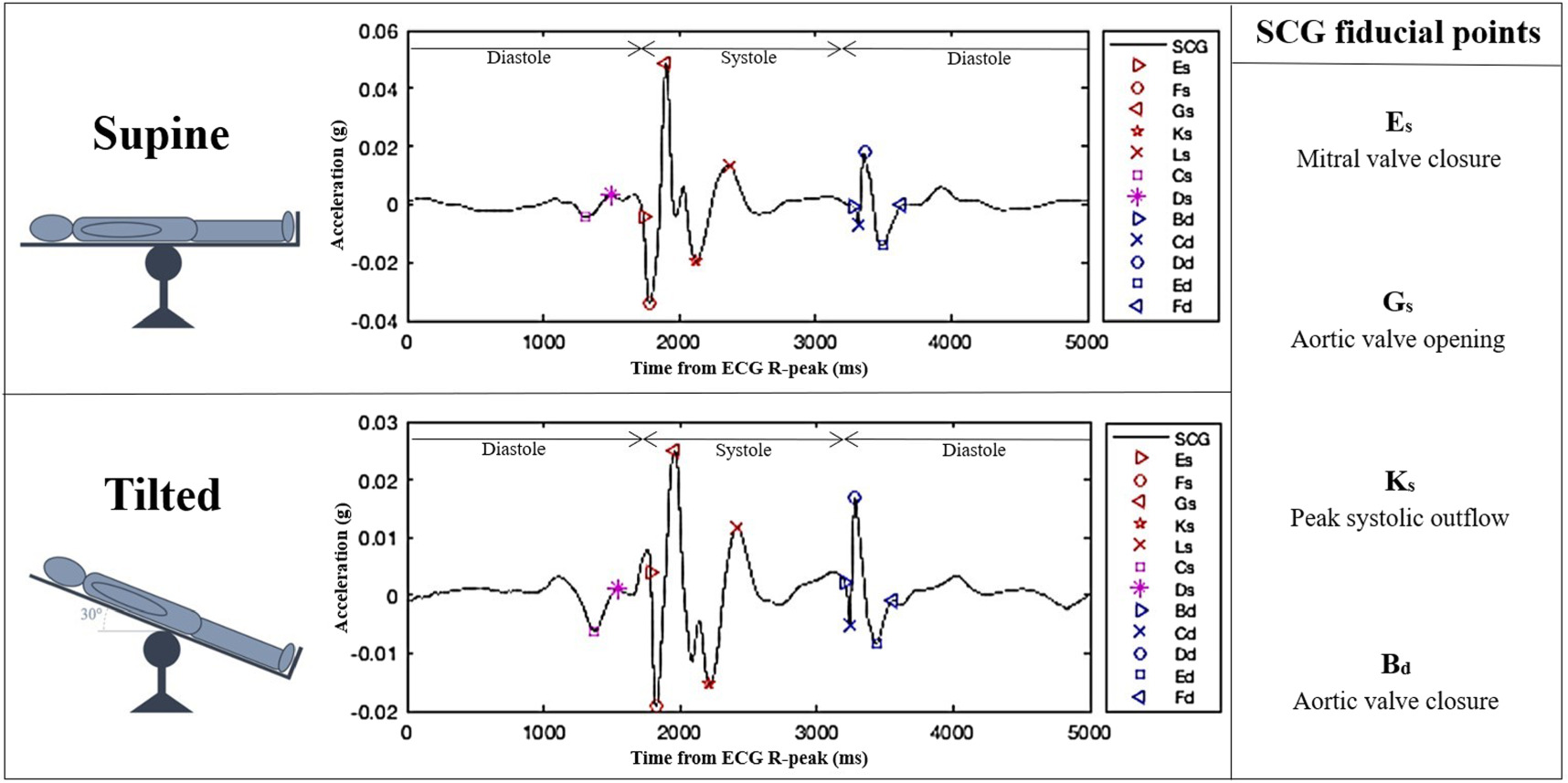 Seismocardiography and echocardiography: the correlation in the ...