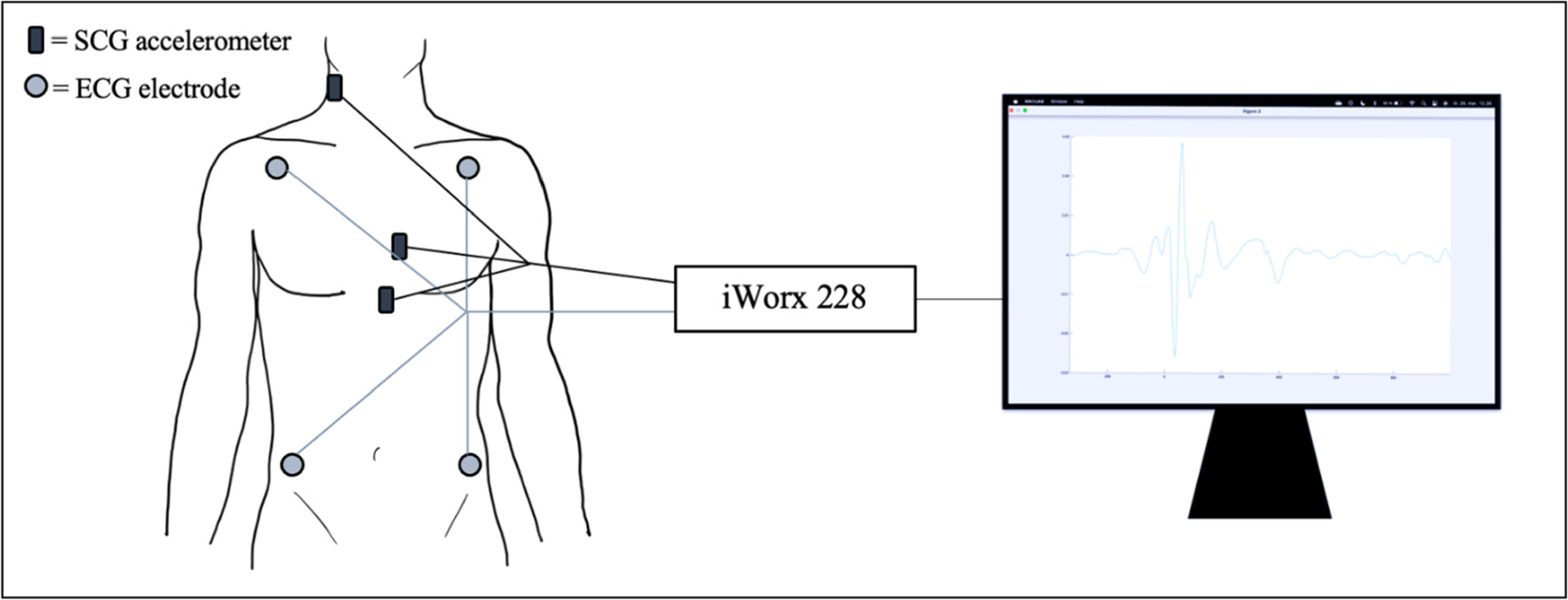 Seismocardiography and echocardiography: the correlation in the ...
