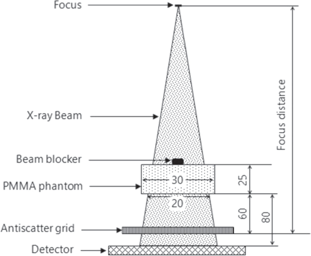 A new method to assess the performance of anti-scatter grids in x-ray ...